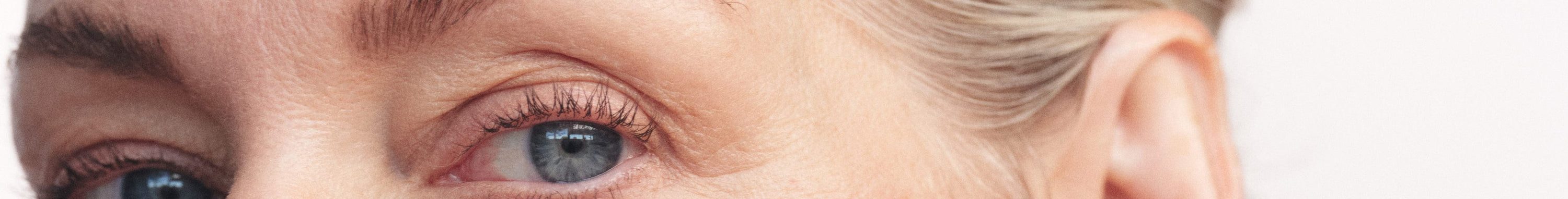 Fine Lines Skincare Solutions – Ultraceuticals NZ